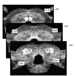 Invertebrate Brain Platform - Bombyx Standard Brain