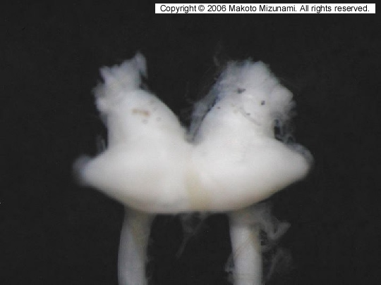 Invertebrate Brain Platform