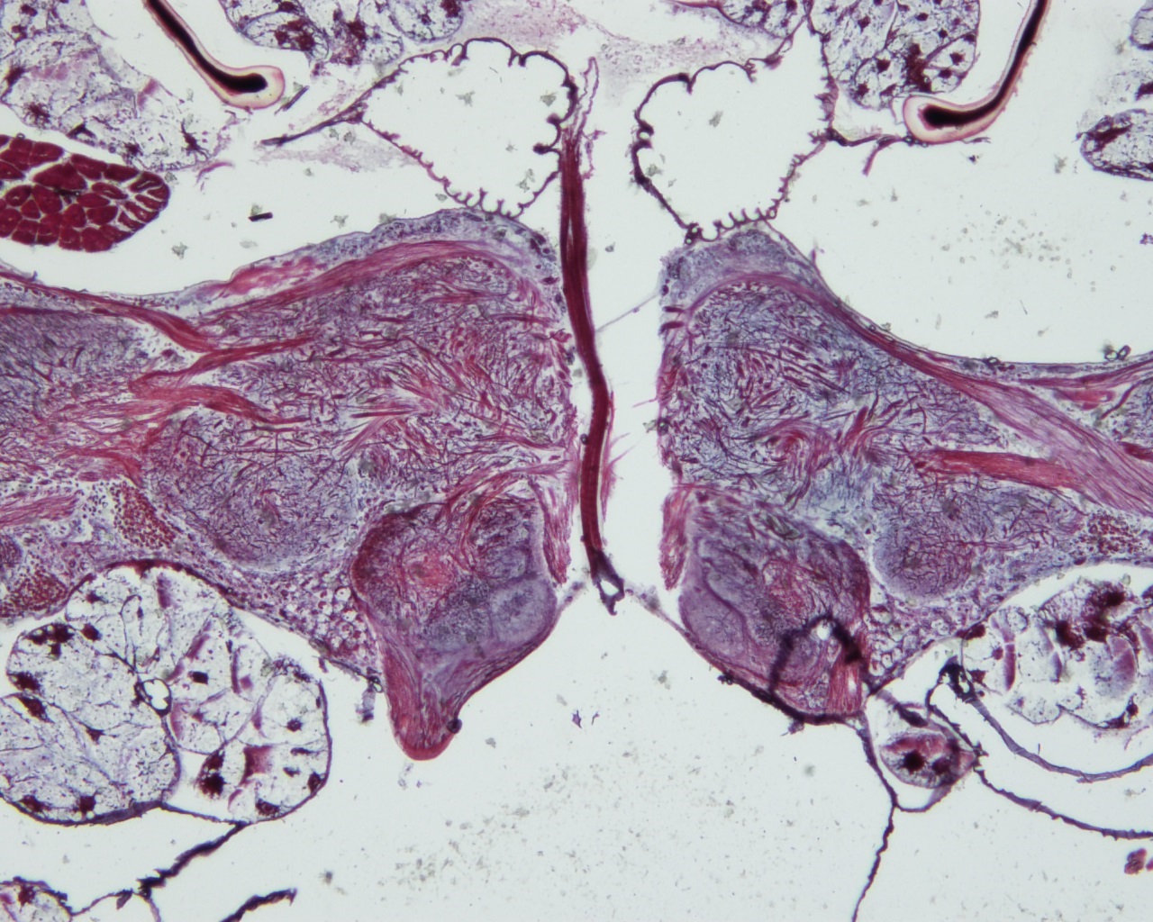Invertebrate Brain Platform - Protophormia terraenovae