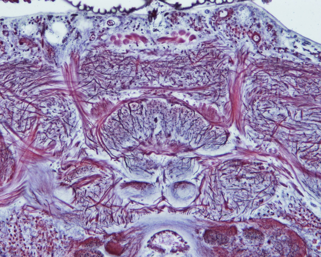 Invertebrate Brain Platform - Protophormia terraenovae