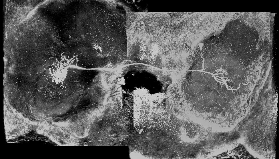 Invertebrate Brain Platform - Moth Brain & Neurons