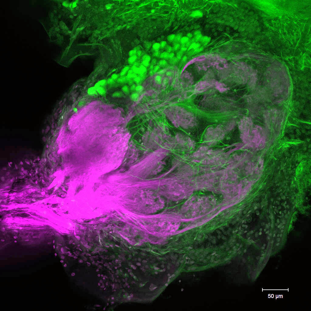 Invertebrate Brain Platform - Male antennal lobe-double label